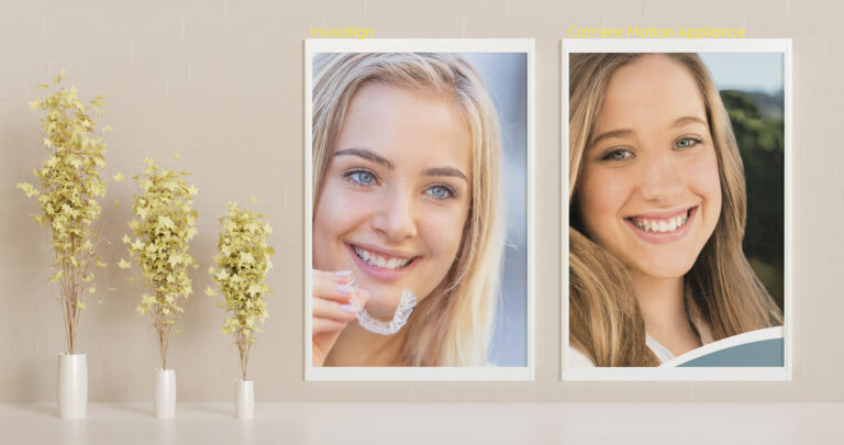 Invisalign & Carriere Motion Appliance | Moira Wong trading as Moira ...